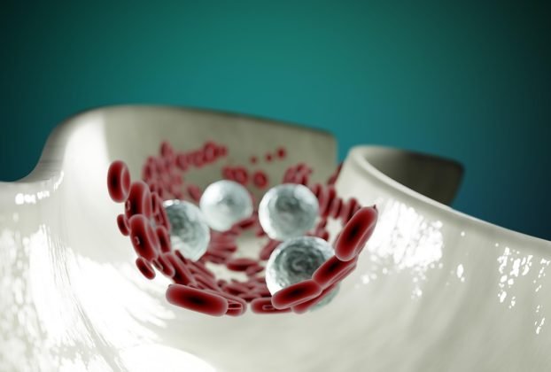 Dalingo 82,5 mg: ¿Para qué sirve y cuándo se utiliza?